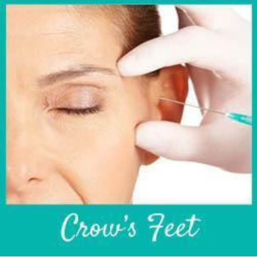 Injection-free natural botox® alternative